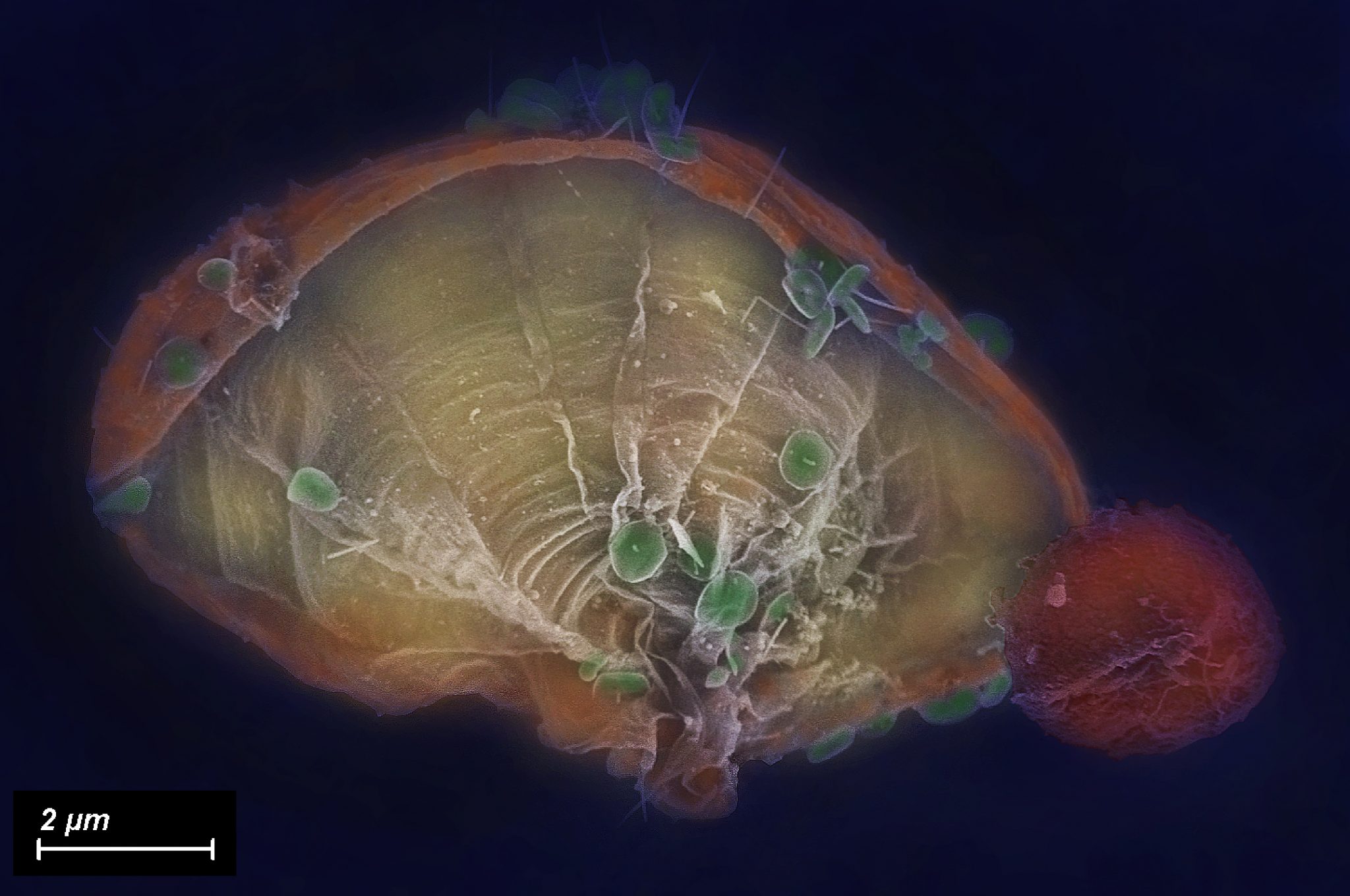 ISM2025 | Micrographs Competition