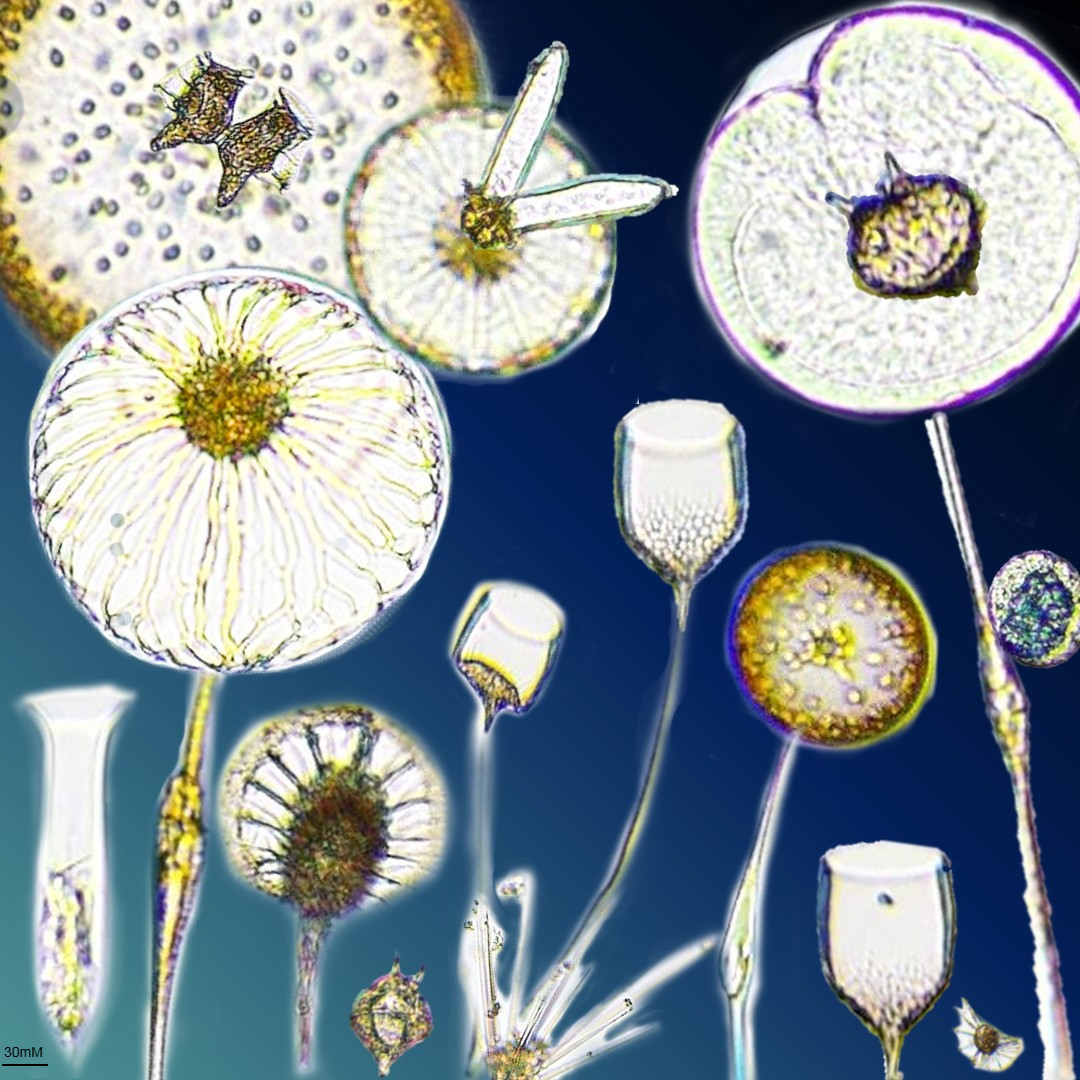 ISM2025 | Micrographs Competition